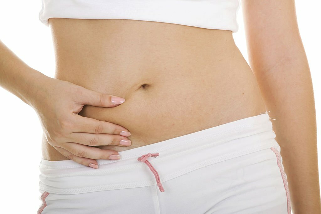 Everything You Need To Know About Navel Surgery - Tynor Australia